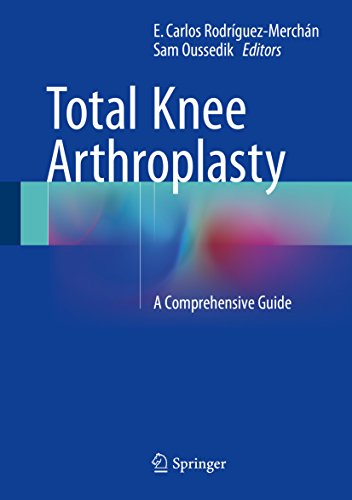 Amazon.com: Total Knee Arthroplasty: A Comprehensive Guide eBook ...