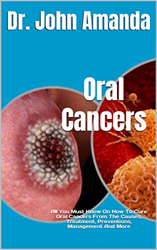 Oral Cancers : All You Must Know On How To Cure Oral Cancers From The ...