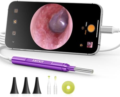 Amazon.com: Teslong Digital Otoscope, 1080p HD Ear Camera with Ear Wax ...