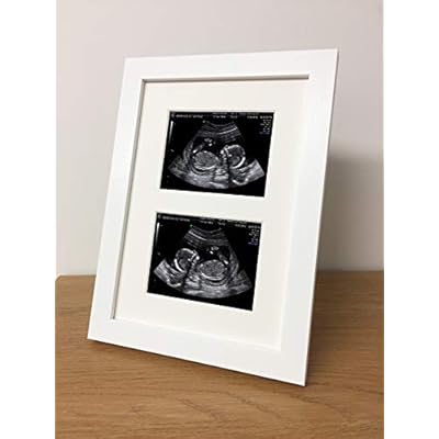 Amazon.co.uk: Baby's Scan Photo Frame