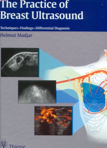 The Practice of Breast Ultrasound: Techniques, Findings, Differential ...