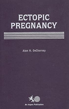 Ectopic pregnancy: Cherney, Alan H.De: 9780871892973: Amazon.com: Books