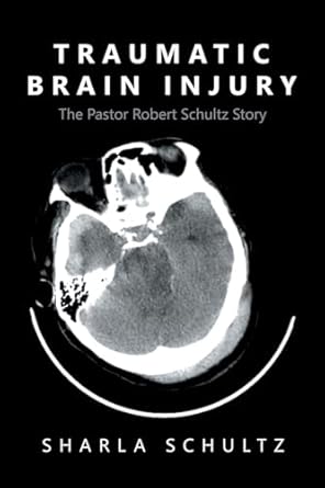 Traumatic Brain Injury: The Pastor Robert Schultz Story: Schultz, Sharla: 9781669879909: Amazon ...