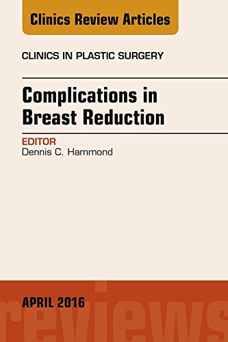 Amazon.com: Complications in Breast Reduction, An Issue of Clinics in ...