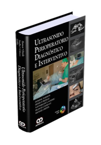 Ultrasonido perioperatorio diagnostico e interventivo (Spanish Edition ...
