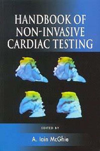 Handbook of Non-Invasive Cardiac Testing: McGhie, A. Iain ...