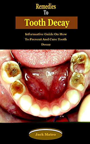Remedies To Tooth Decay: Remedies To Tooth Decay: Informative Guide On ...
