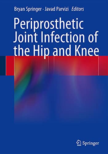 Amazon | Periprosthetic Joint Infection of the Hip and Knee | Parvizi ...