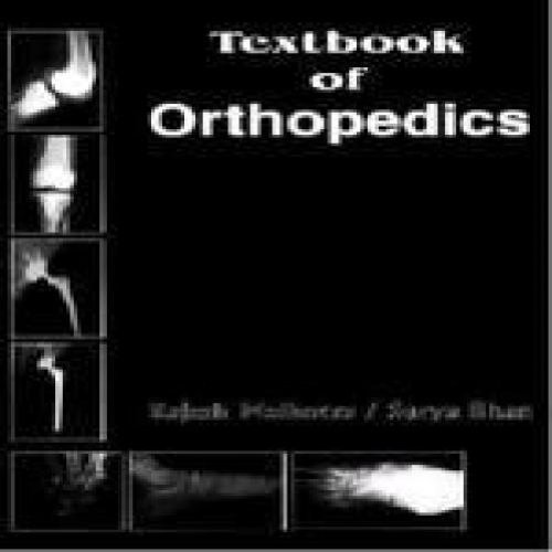 Buy Textbook Of Orthopedics Book Online at Low Prices in India ...