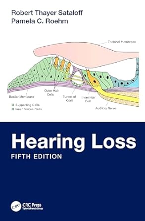 Hearing Loss: 9781032567594: Medicine & Health Science Books @ Amazon.com