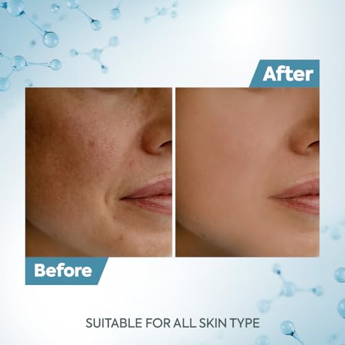 Raaga Professional De-Tan Pack with Kojic, Lactic Acid & Arbutin | Tan ...