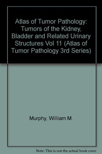 Buy Tumors of the Kidney, Bladder and Related Urinary Structures (Vol ...