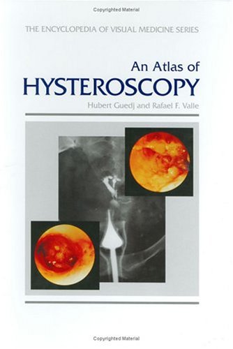 An Atlas of Hysteroscopy (Encyclopedia of Visual Medicine Series ...