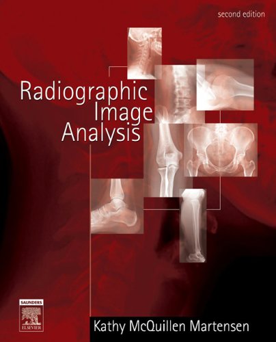 Radiographic Image Analysis: 9780721639253: Medicine & Health Science ...