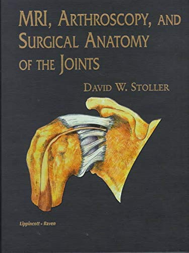 Mri, Arthroscopy, and Surgical Anatomy of the Joints : Stoller, David W ...