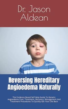 Reversing Hereditary Angioedema Naturally: The Evidence Based Self Help ...