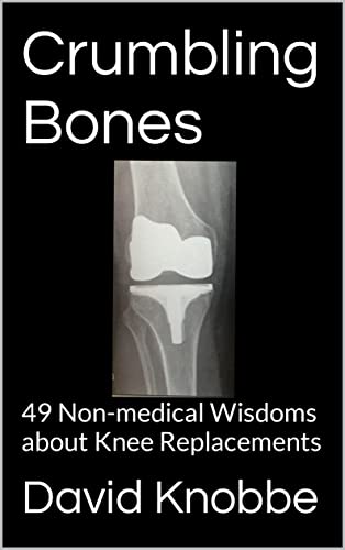 Amazon.com: Crumbling Bones: 49 Non-medical Wisdoms about Knee ...