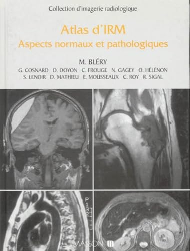 Amazon.in: Buy ATLAS D'IRM. Aspects normaux et pathologiques Book ...