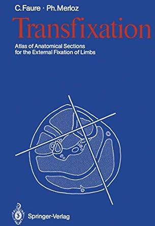 Transfixation: Atlas of Anatomical Sections for the External Fixation ...