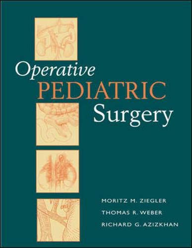 Operative Pediatric Surgery: 9780838574058: Medicine & Health Science ...