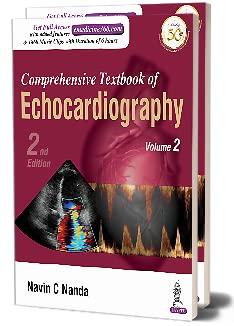 Buy Comprehensive Textbook Of Echocardiography 2nd Edition (Volume 2 ...