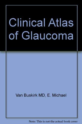 Clinical Atlas of Glaucoma: 9780721614496: Medicine & Health Science ...