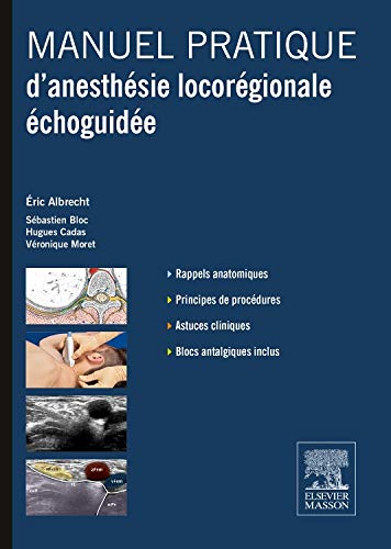Manuel pratique d'anesthésie locorégionale échoguidée: Albrecht, Eric ...