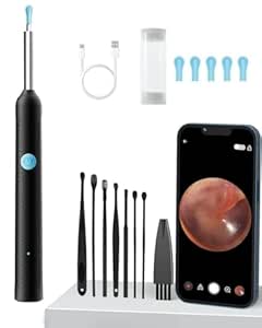 Buy EarNova Earocam Earwax Removal Tool Kit with HD Camera WiFi Connection & 6 LED Lights ...