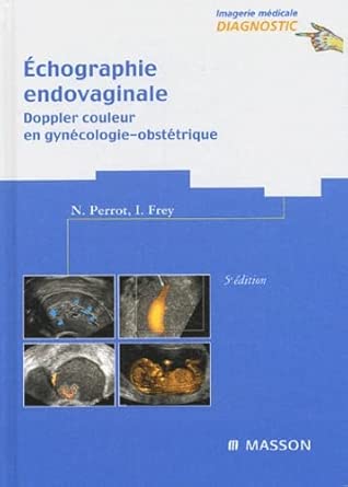 Echographie endovaginale: Doppler couleur en gynécologie-obstétrique ...