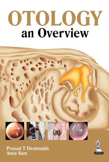 Otology: an Overview: 9789351520801: Medicine & Health Science Books ...