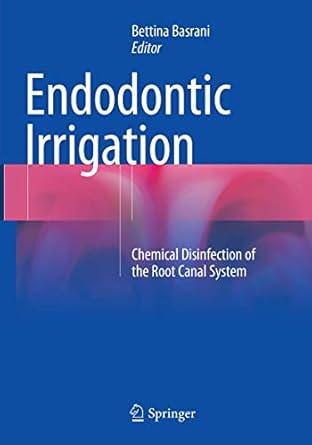 Amazon.com: Endodontic Irrigation: Chemical disinfection of the root ...