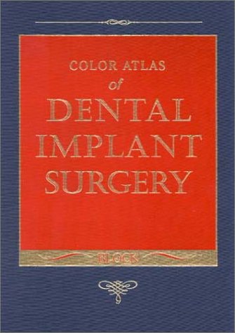 Color Atlas of Dental Implant Surgery: 9780721683171: Medicine & Health ...