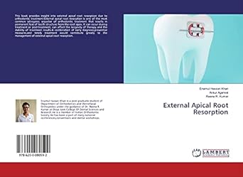 External Apical Root Resorption : Reena R. Kumar: Amazon.in: Books