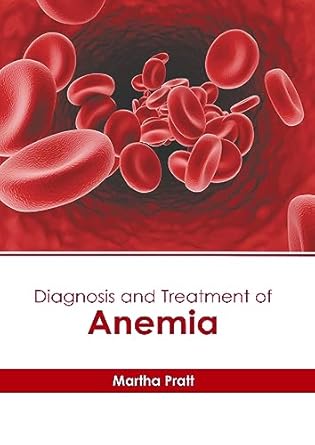 Diagnosis and Treatment of Anemia: 9781639897612: Medicine & Health ...