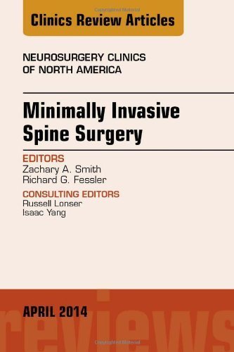 Minimally Invasive Spine Surgery, An Issue of Neurosurgery Clinics of ...