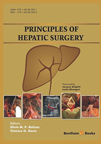 Principles of Hepatic Surgery: Balzam, Silvio, Gava, Vinícius ...