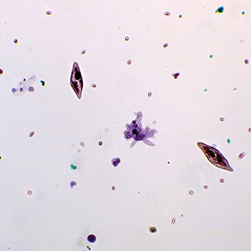 Mixed Protozoa, W.M. Microscope Slide: Microscope Sample Slides: Amazon ...