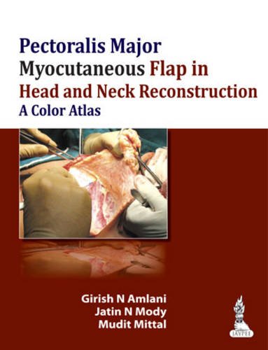 Pectoralis Major Myocutaneous Flap in Head and Neck Reconstruction: A ...