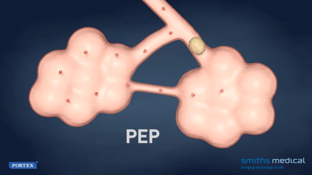 Watch Vibratory PEP Therapy System on Amazon Live