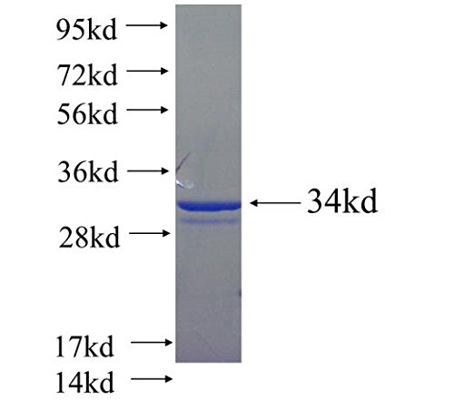 Amazon.com: Human LIN54 Fusion Protein : Industrial & Scientific
