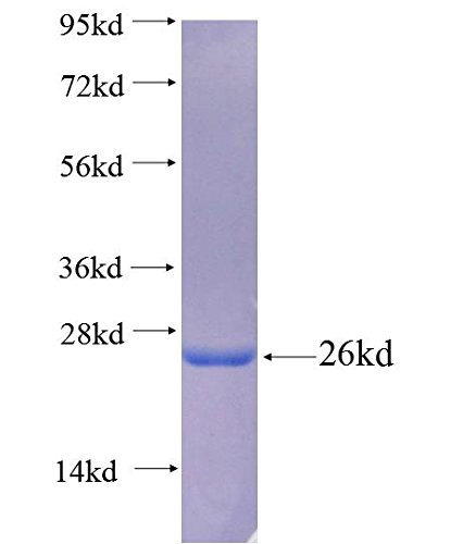 Amazon.com: Human LIMPII Fusion Protein : Industrial & Scientific