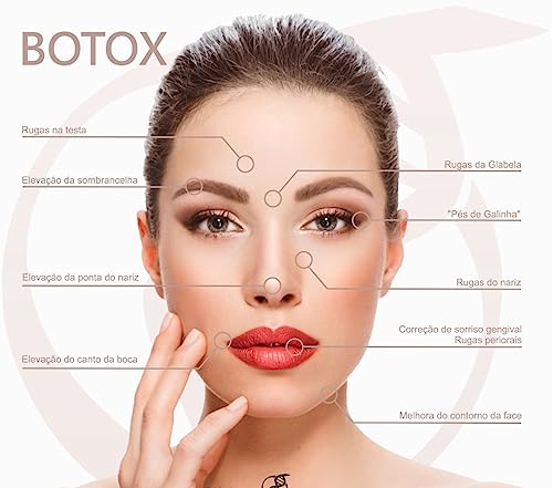Techniques and Appointments Botulinum Toxin (Botox) eBook : for ...