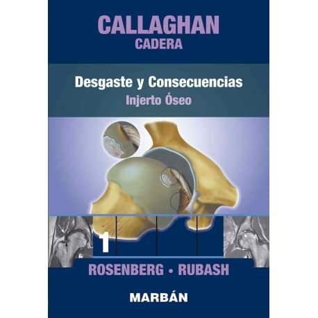 Callaghan Cadera 1: Desgaste y Consecuencias. Injerto Óseo : John J ...