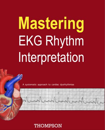 Amazon.com: Mastering EKG Rhythm Interpretation: A systematic approach ...
