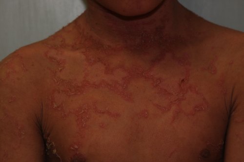 Rare Dermatological Diseases eBook : Di Cicco, Camillo: Amazon.co.uk: Books