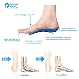 We Chose The Best Medial Arch Support Insoles in The UK - 10/2025 ...