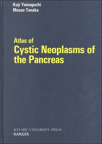 Atlas of Cystic Neoplasms of the Pancreas: Yamaguchi, Koji, Tanaka, Masao: 9783805570558: Amazon ...