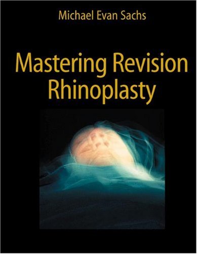 Mastering Revision Rhinoplasty: Michael Evan Sachs: 9780387308401 ...