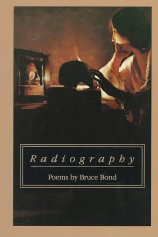 Radiography : Poems: Bond, Bruce: 9781880238516: Amazon.com: Books