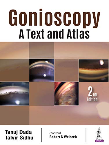 Gonioscopy: A Text and Atlas eBook : Dada, Tanuj, Sidhu, Talvir: Amazon ...